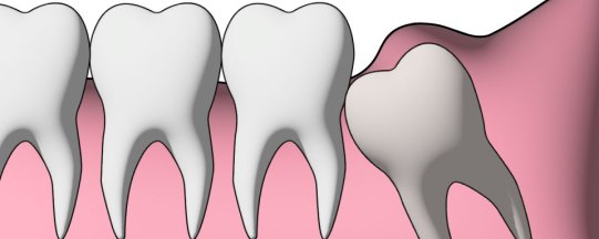 Oral Surgeon Tuscaloosa AL | University Oral and Facial Surgery, P.C.